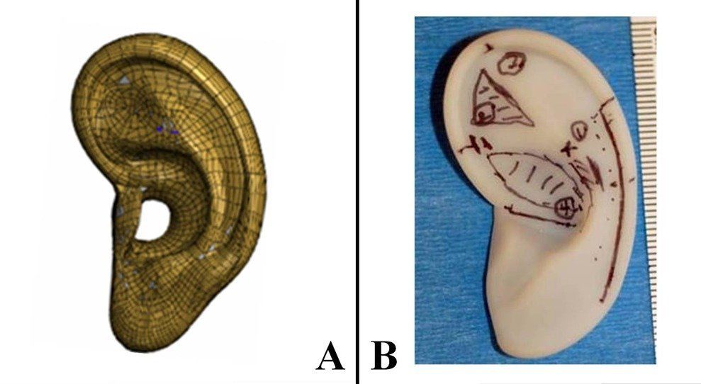 How Artificial Ear Grew on Rat's Back | Live Science