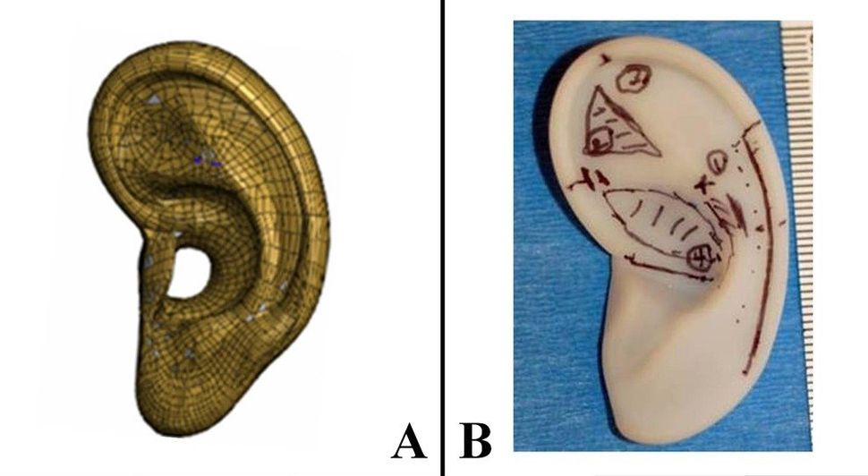How Artificial Ear Grew on Rat's Back | Live Science