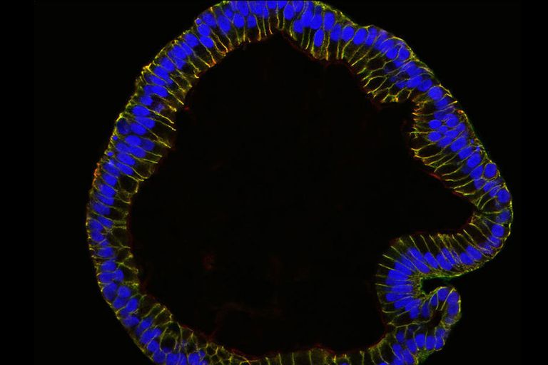 Body parts grown in the lab | Live Science