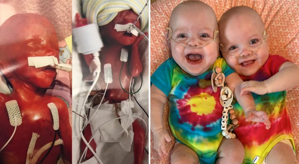 10 of the strangest pregnancies in the world | Live Science