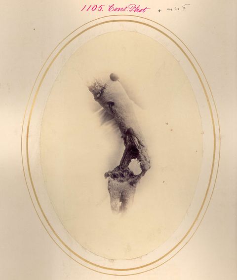 Album: Faces and Injuries of the Civil War: Page 2 | Live Science