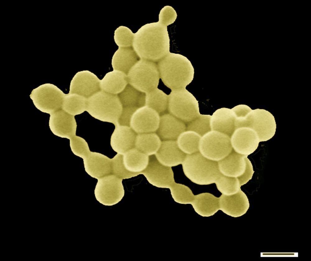 This Bacteria Eats Toxic Metal, 'Poops' Gold Nuggets | Live Science