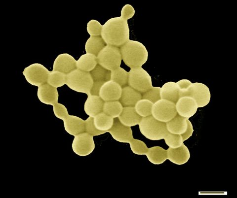 This Bacteria Eats Toxic Metal, 'Poops' Gold Nuggets | Live Science
