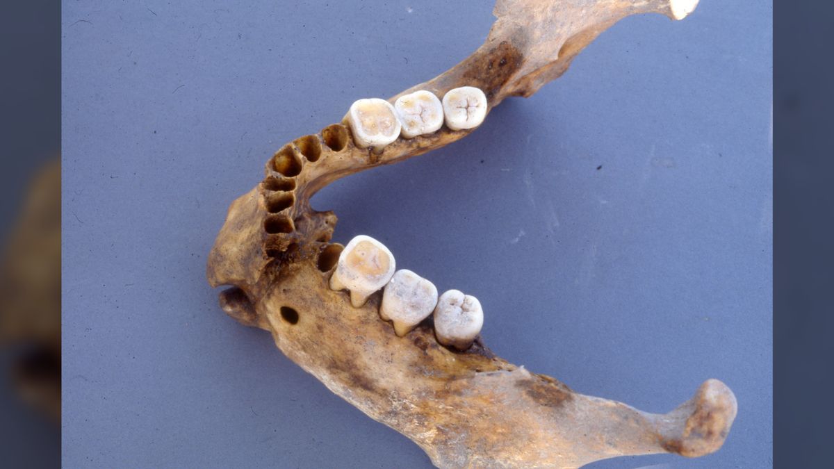 Byzantine warrior with gold-threaded jaw unearthed in Greece | Live Science