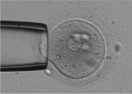 Checking Embryo Viability? Give it a Good Squeeze | Live Science