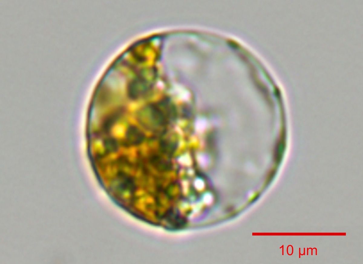 Diatoms Have Sex, and Ammonium Is a Turn-On | Live Science