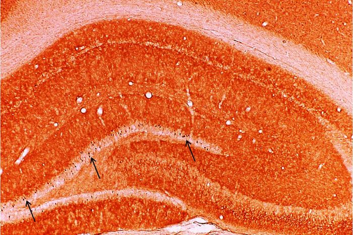 The Arc Gene and Protein Key to Memories | Research in Action | Live ...