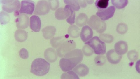 What is babesiosis? The parasitic infection that 'eats' your red blood ...