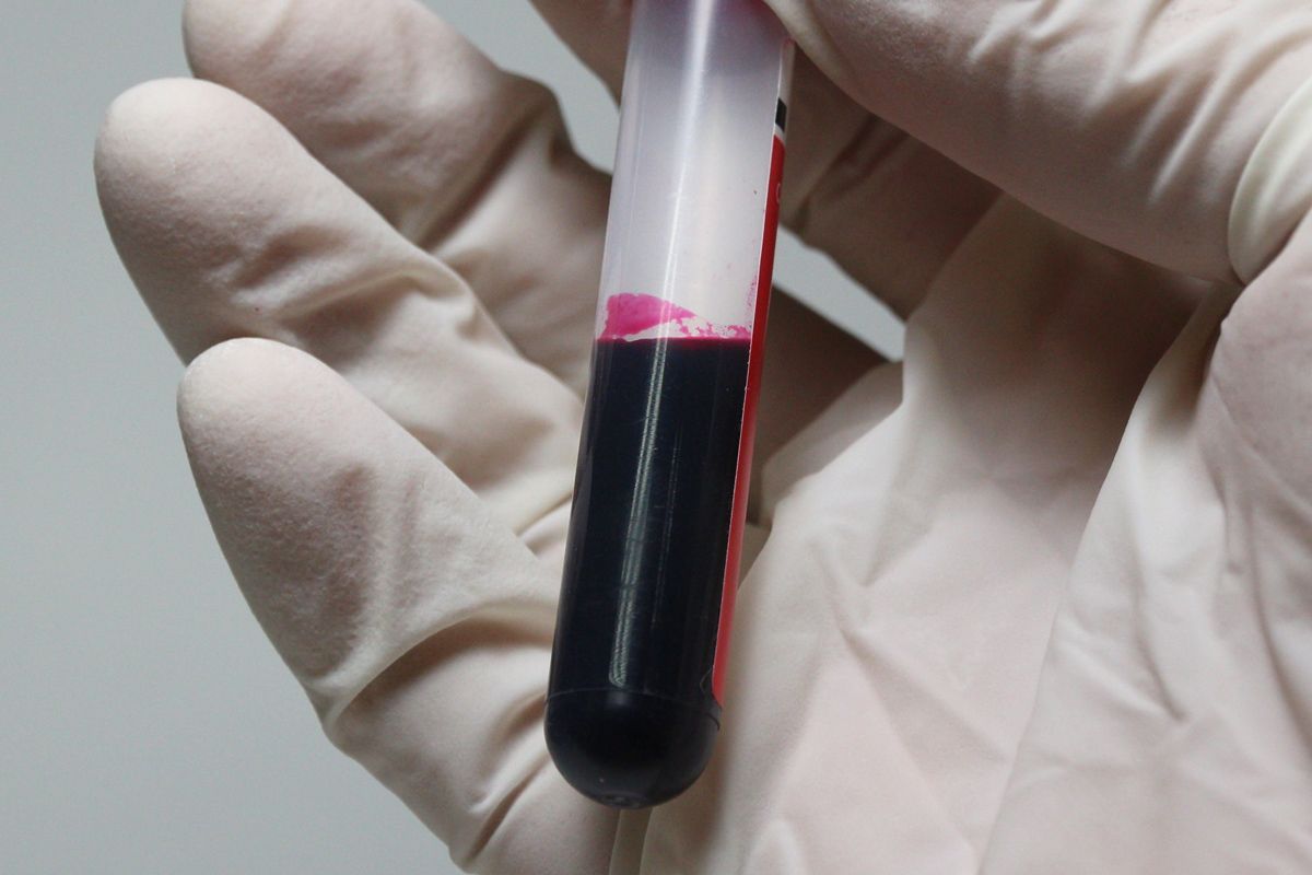 The Color of Blood: Here Are Nature's Reddest Reds (Photos) | Live Science