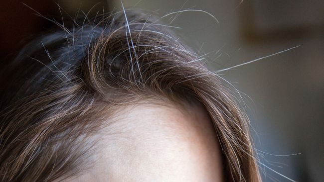 Can gray hair be reversed? | Live Science