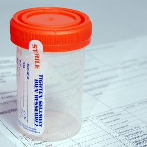 Only in America: The yearbook club's pee test | The Week