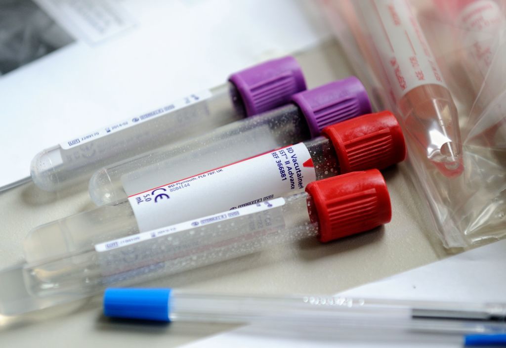 Lab leaks have happened before, and probably more often than you'd ...