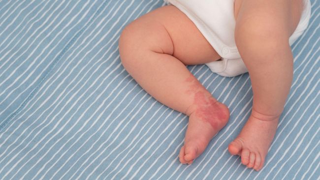 10 common skin conditions | Live Science