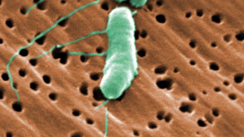 7 scary diseases you can get from the water | Live Science