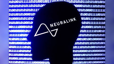 Neuralink chip implanted into human brain for the 1st time, Elon Musk ...