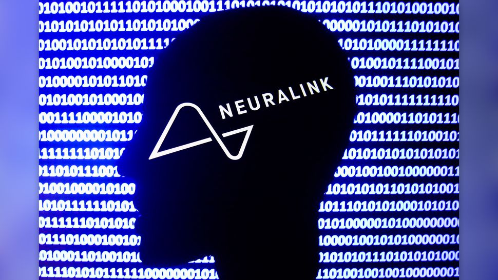 Neuralink Chip Implanted Into Human Brain For The 1st Time Elon Musk