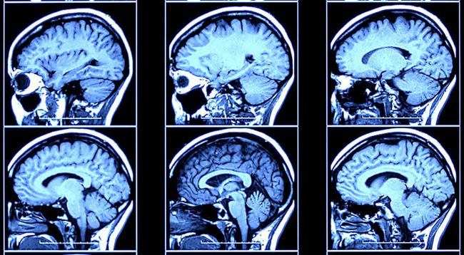 Criminal Minds Are Different From Yours, Brain Scans Reveal | Live Science