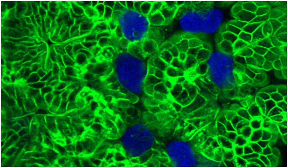 Parasitic Amoeba Chomps on Human Cells to Kill Them | Live Science