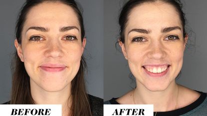 Does Drinking Water Help Your Skin - Facts on Drinking Water for Acne ...