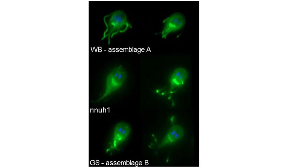 This Parasite Uses Your Own Gut Bacteria Against You | Live Science
