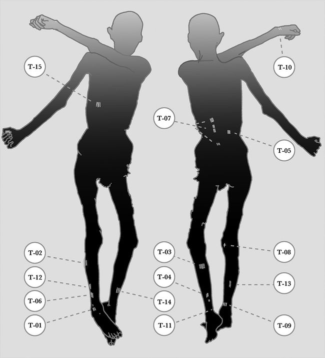 Ötzi the Iceman used surprisingly modern technique for his tattoos ...