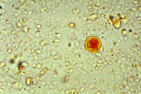 What is an amoeba? | Live Science