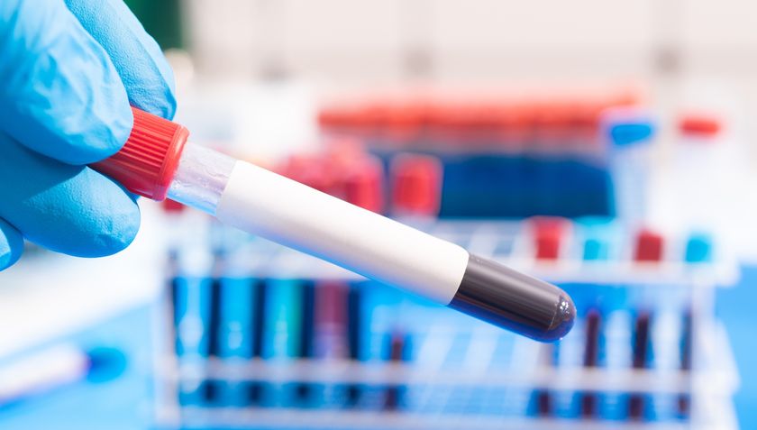 5 Facts about Spit | What's in Saliva? | Live Science