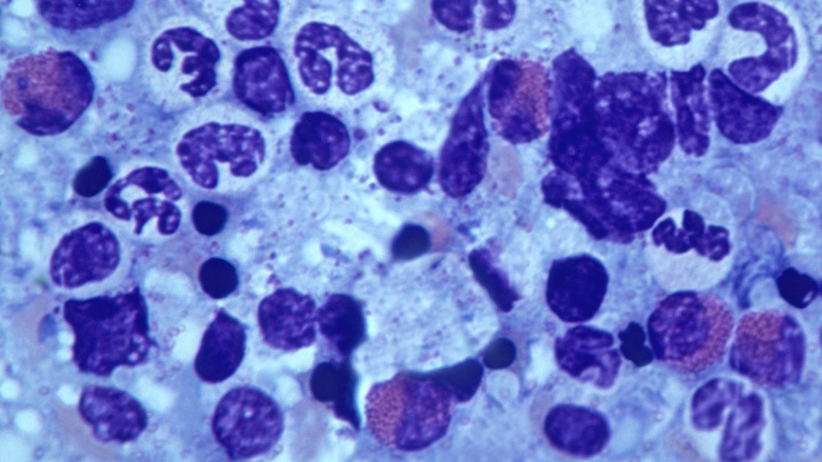 Some cells can enter a 'third state that lies beyond the traditional ...