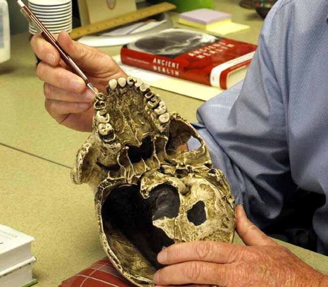 Why Women Have Bad Teeth | Live Science