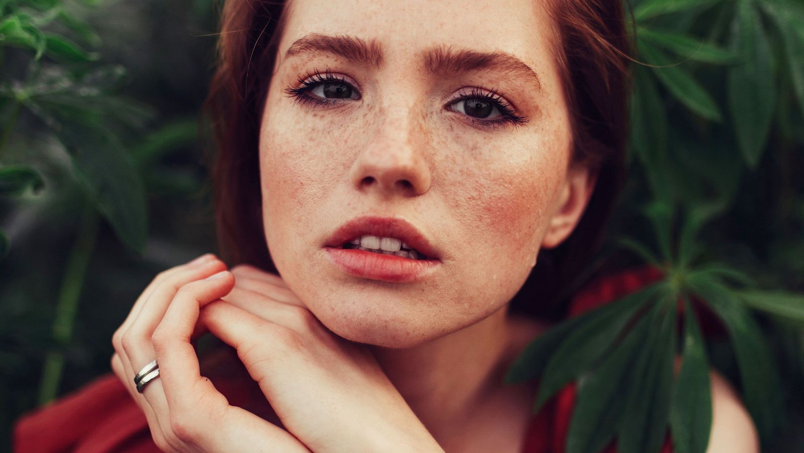 How One Sunburn to Ruined My Face Forever — Melasma Causes and ...