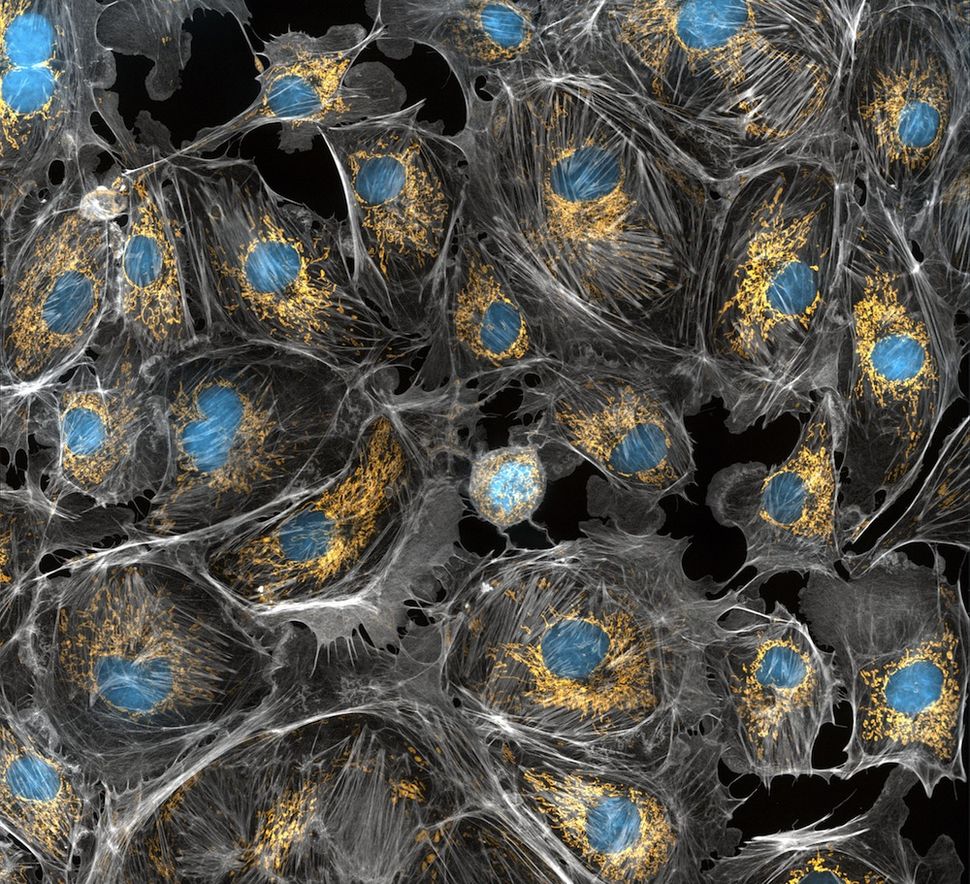 Small World: Gallery of Microscopic Beauty | Live Science