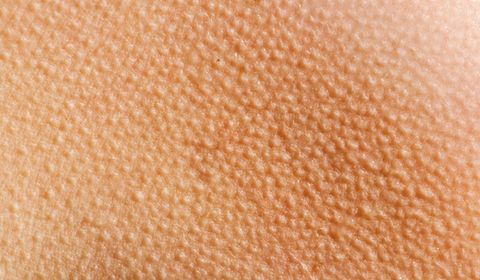 How Much Does Your Skin Weigh? | Live Science