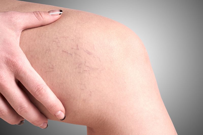 How to Fix 9 Common Skin Problems | Live Science