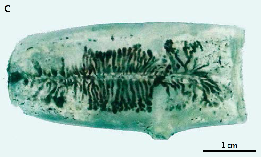 Man Gets 20-Foot Tapeworm from Eating Raw Meat | Live Science