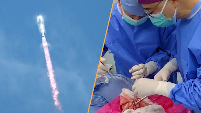 Will brain transplants ever be possible? | Live Science