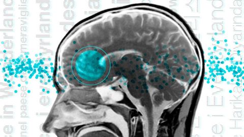 'Universal language network' identified in the brain | Live Science