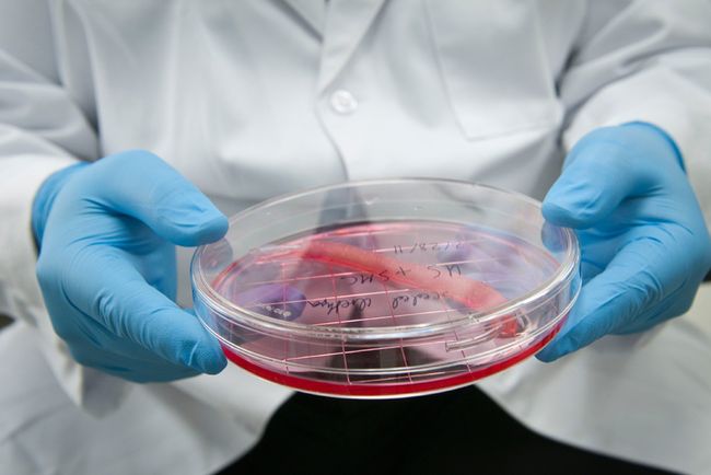 Body parts grown in the lab | Live Science