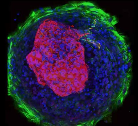 11 Body Parts Grown in the Lab | Live Science