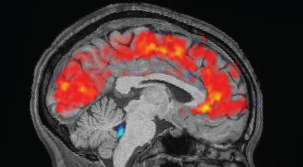 Study reveals why the brain 'zones out' when you're exhausted | Live ...