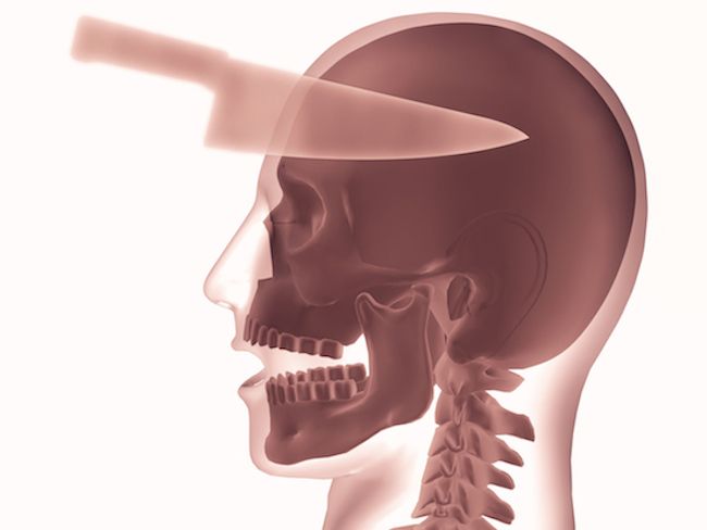 This Man Survived a Knife Through His Brain | Live Science