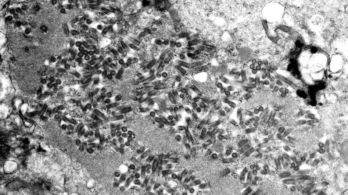 5 people died of rabies in the U.S. in 2021 | The Week