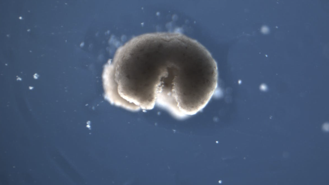 Health news, features and articles | Live Science