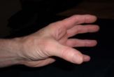 Finger Length Predicts Aggression in Men | Live Science