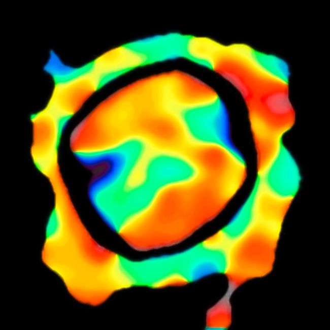 See the Best-Ever Imagery of a Star Beyond the Sun (Photos, Video) | Space