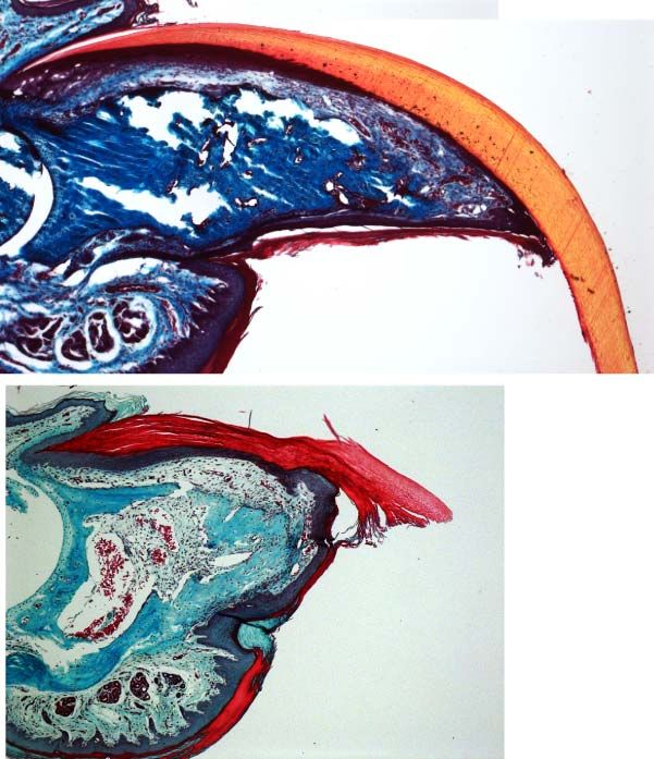 How Amputated Finger Tips Regenerate | Stem Cells | Live Science