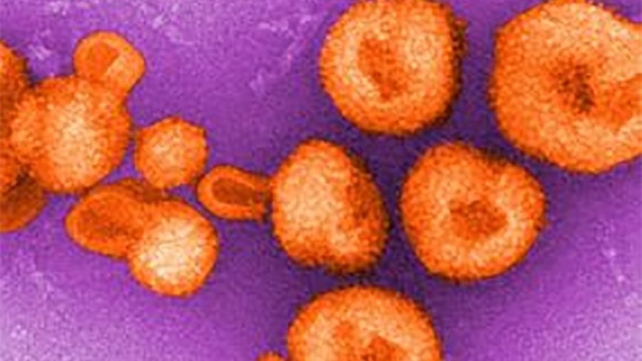 Deadly hemorrhagic fever in Bolivia can spread between people | Live ...
