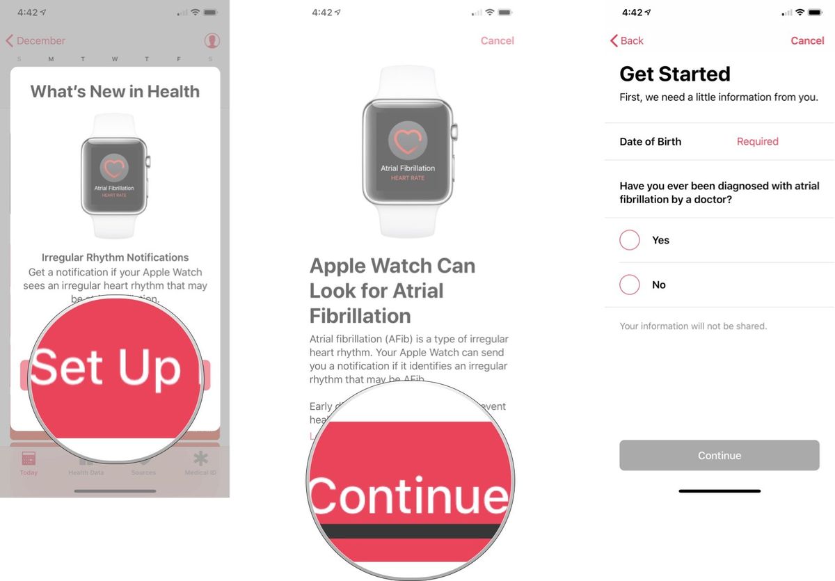 ECG Apple Watch App: The Ultimate Guide | iMore