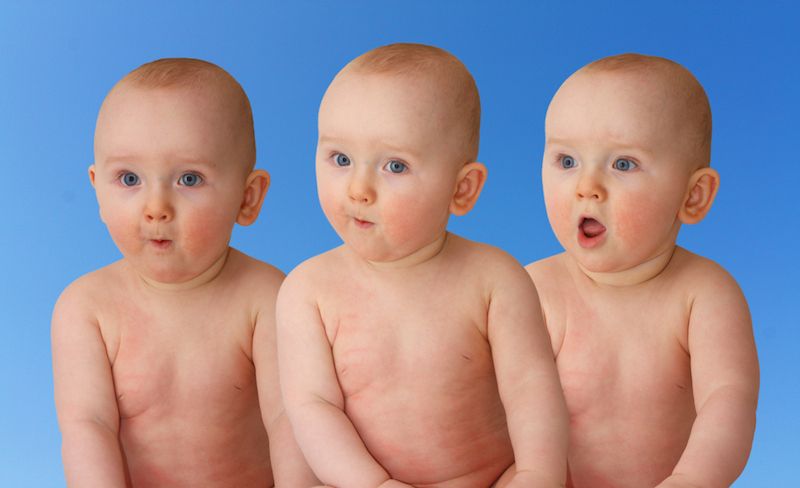 The Science of Identical Triplets and Quadruplets | Live Science
