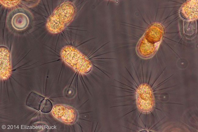 The Diversity of Diatoms | Live Science