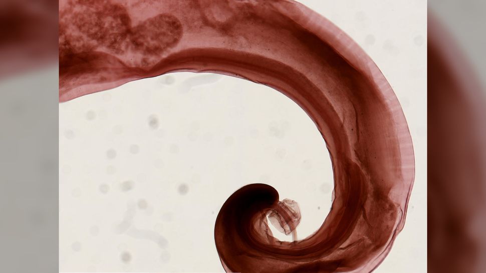 32 scary parasitic diseases | Live Science